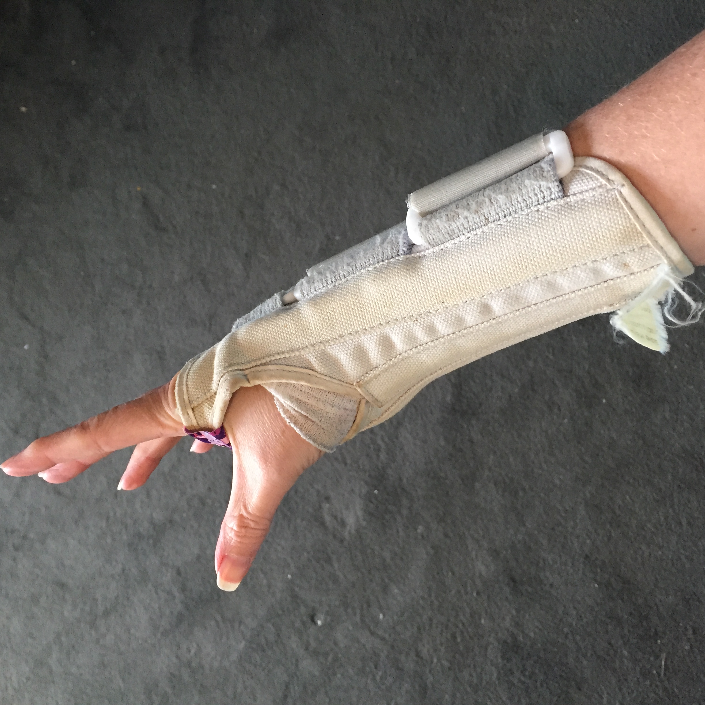Ganglion Cyst Removal Excision Recovery Pictures Jenny Smith Ganglion Cyst Removal Excision Recovery Pictures Jenny Smith